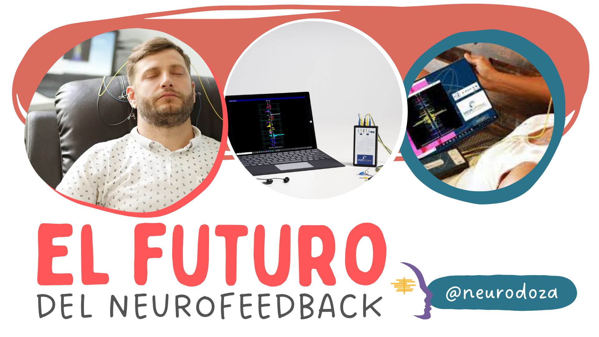 El Futuro Del Neurofeedback Neurodoza