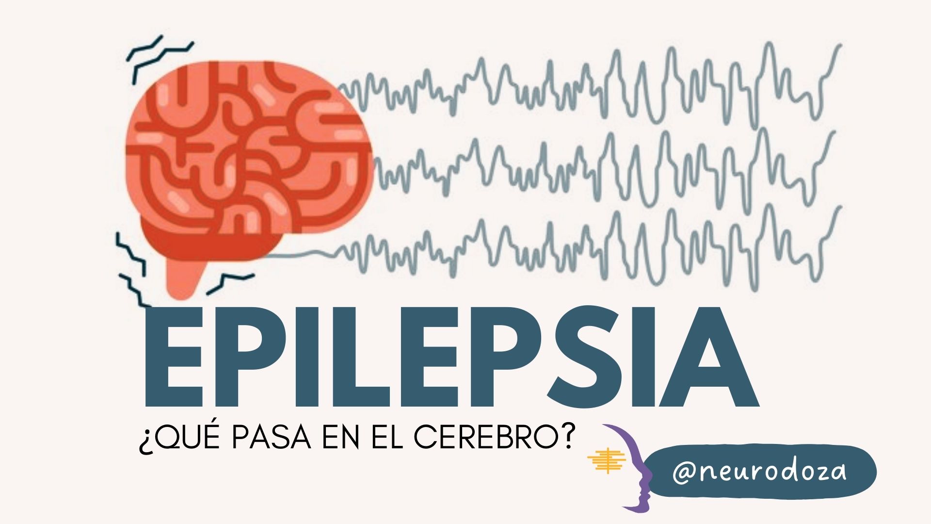 ¿Qué pasa en el cerebro de una persona con epilepsia? - NeuroDoza